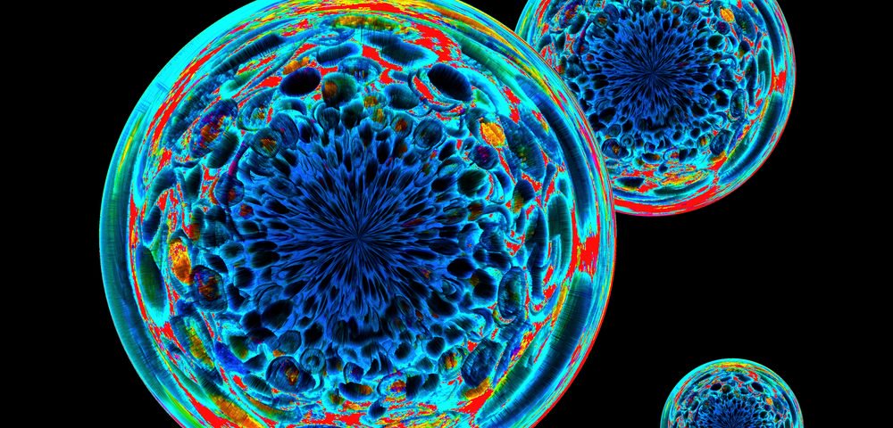 Excess Body Fat Could Worsen MS Progression - Multiple Sclerosis News ...