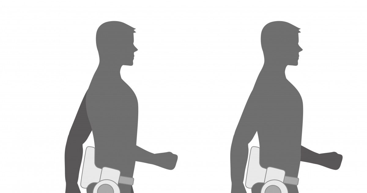 UK Clinical Trials Testing Robotic Legs That Might Allow Patients to ...