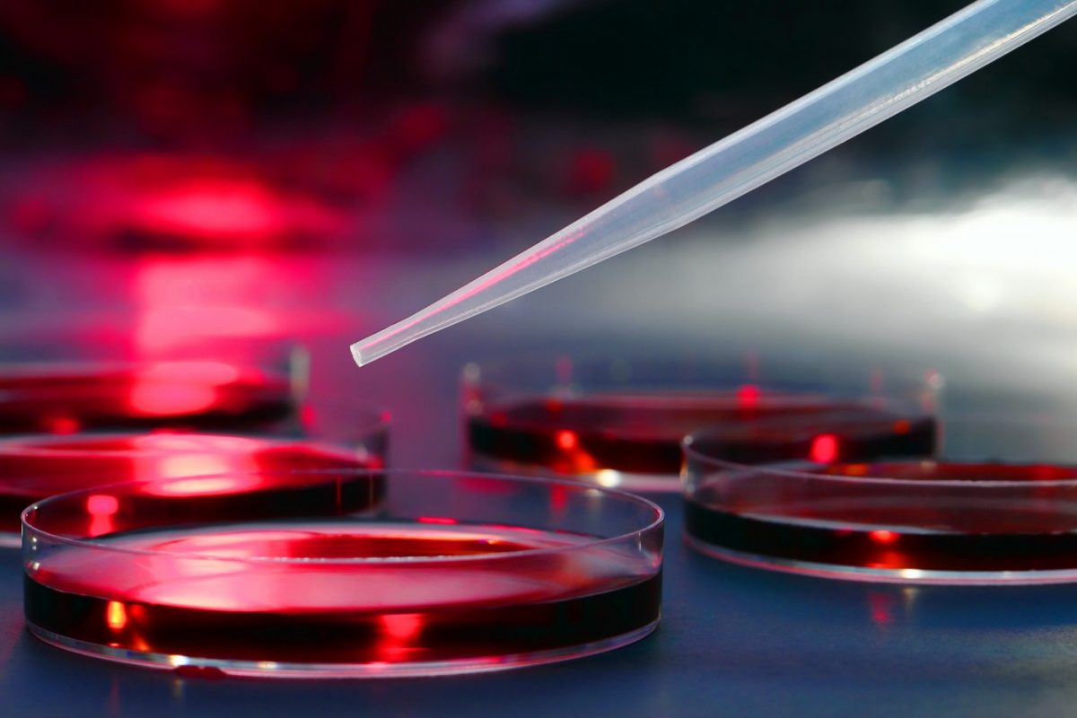 Treat Stem Cell Therapies as 'Blood Tissue Product' StemGenex Tells FDA