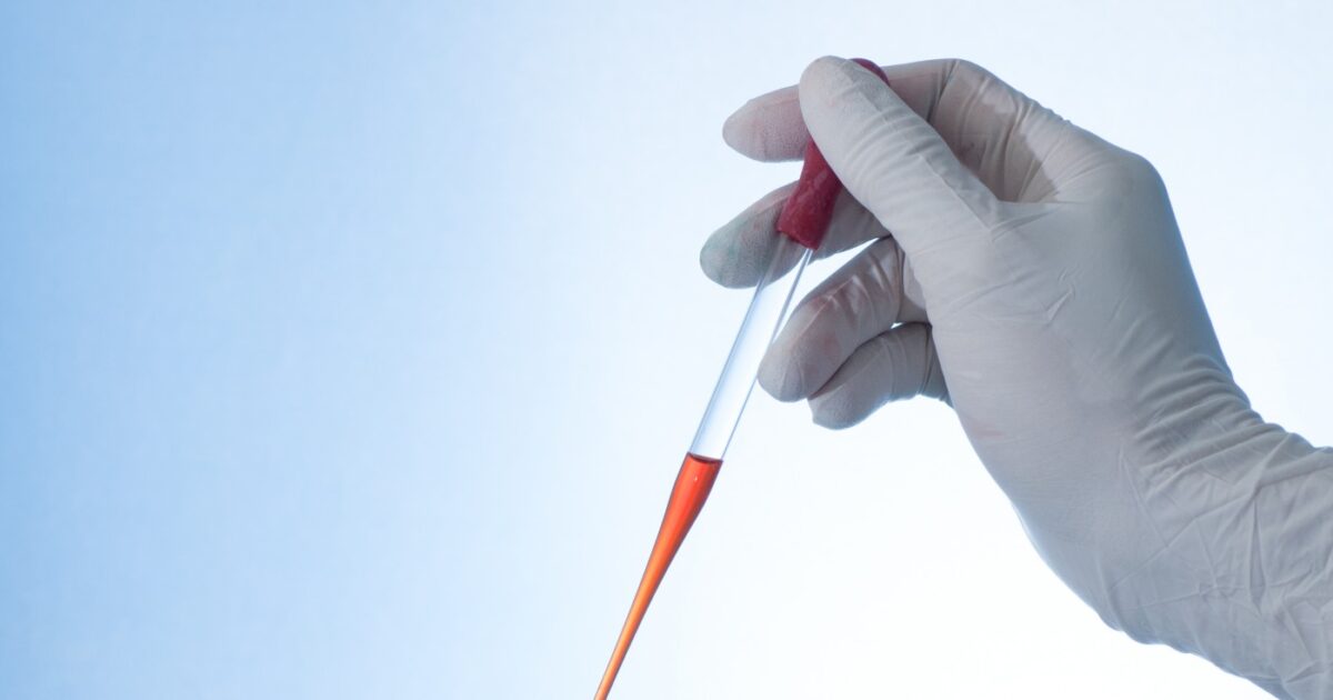 MS Diagnostic Blood Test to Be Released in May is Faster, More Accurate ...