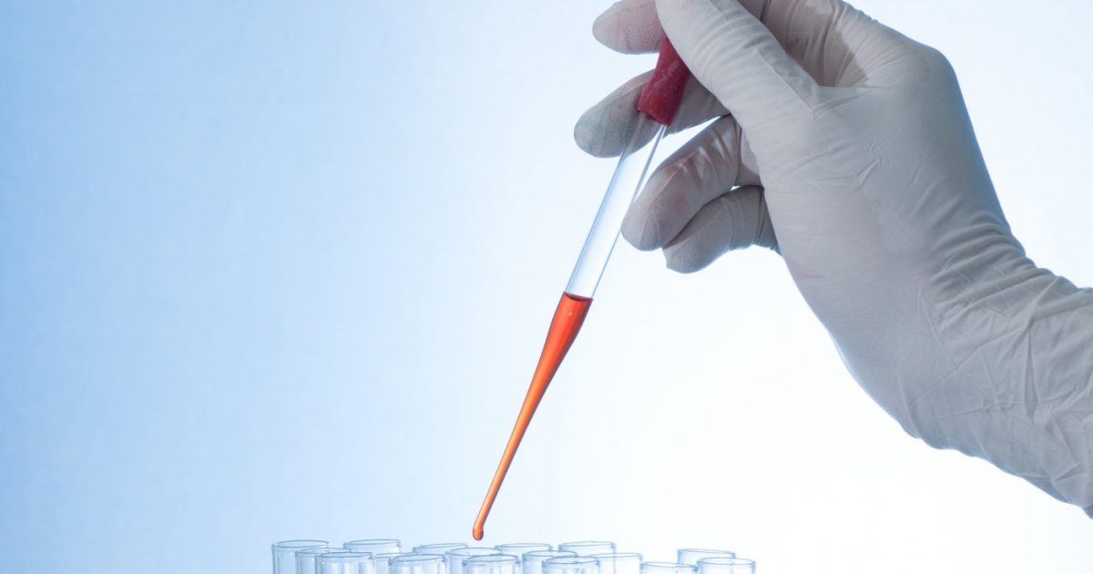 MS Diagnostic Blood Test to Be Released in May is Faster, More Accurate ...