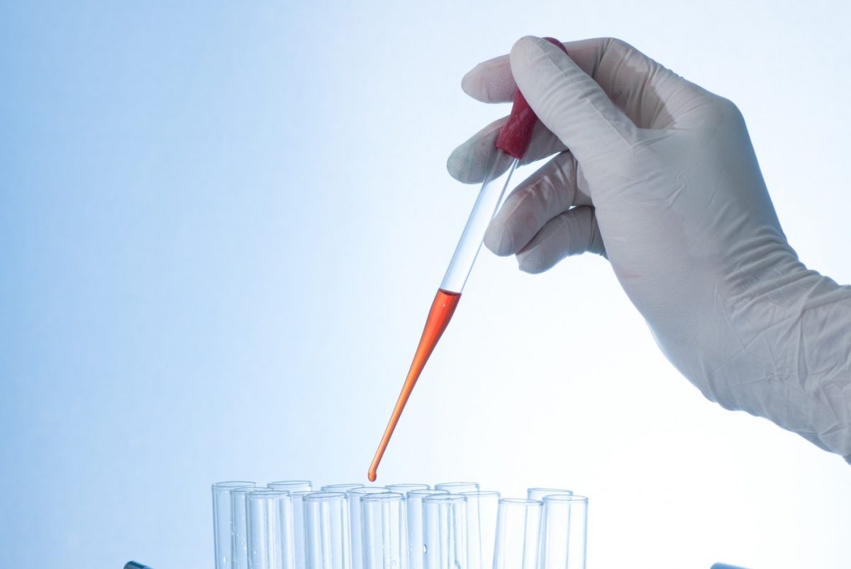 MS Diagnostic Blood Test to Be Released in May is Faster, More Accurate ...