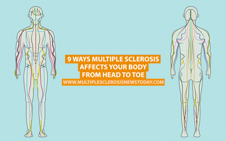 MS Patients Deserve the Best Care: Here's How We Can Obtain It