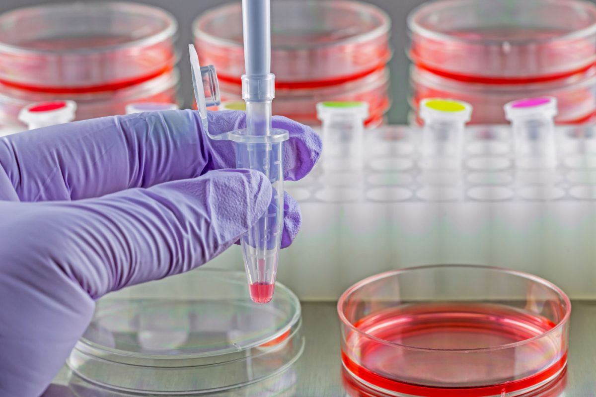 MS Remyelination Focus of GSK Research Into Potential Target for ...