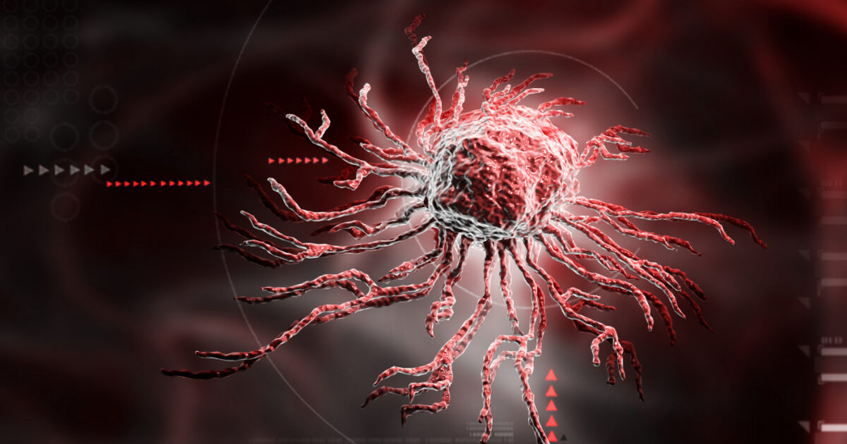 HSCT Better than DMTs at Reducing RRMS Progression, Study Finds