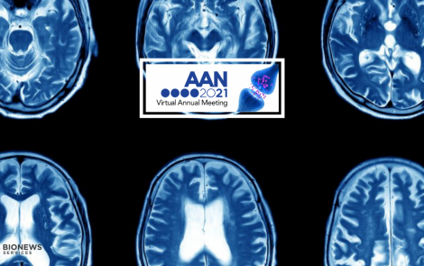 7 Strange and Unusual Symptoms of Multiple Sclerosis