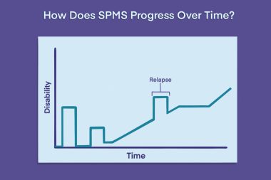Secondary progressive multiple sclerosis | Multiple Sclerosis News Today