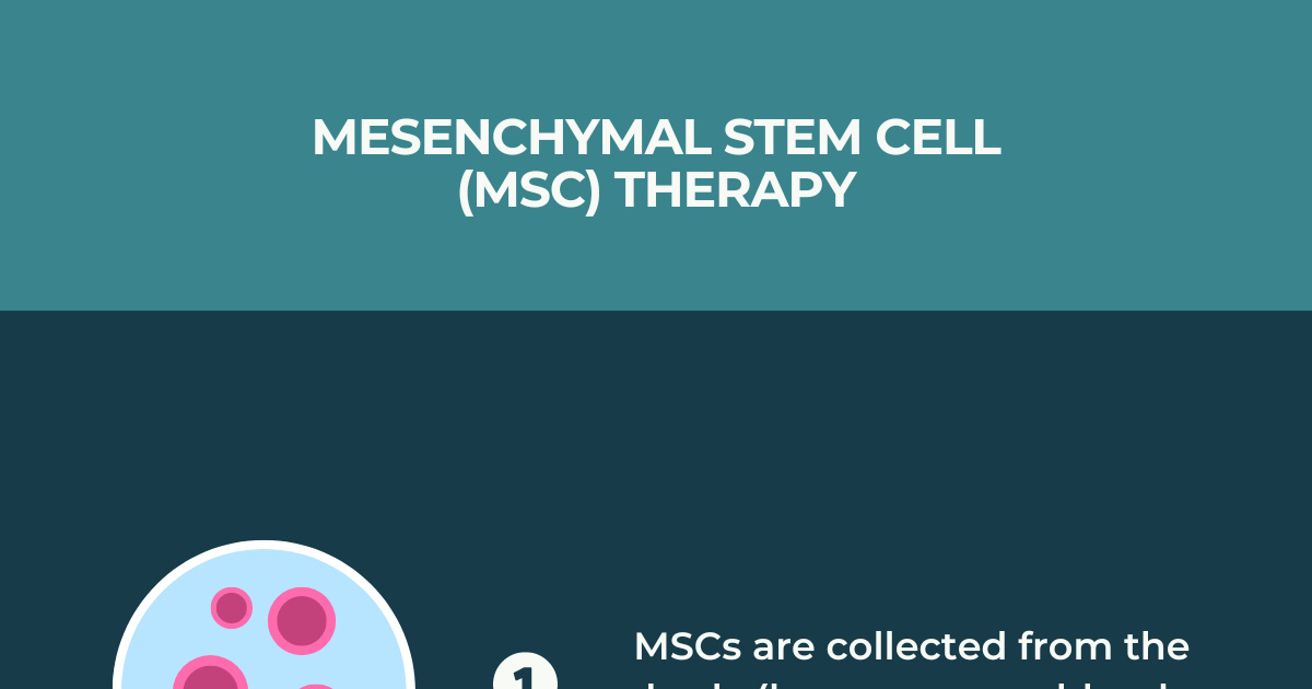 Stem cell therapy for MS | Multiple Sclerosis News Today