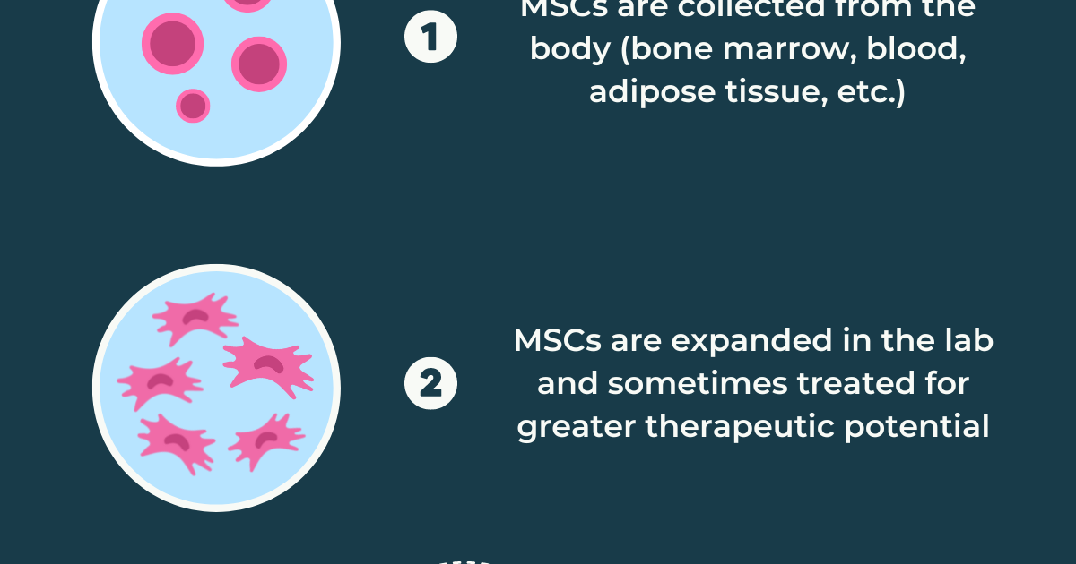 Stem cell therapy and MS | Multiple Sclerosis News Today