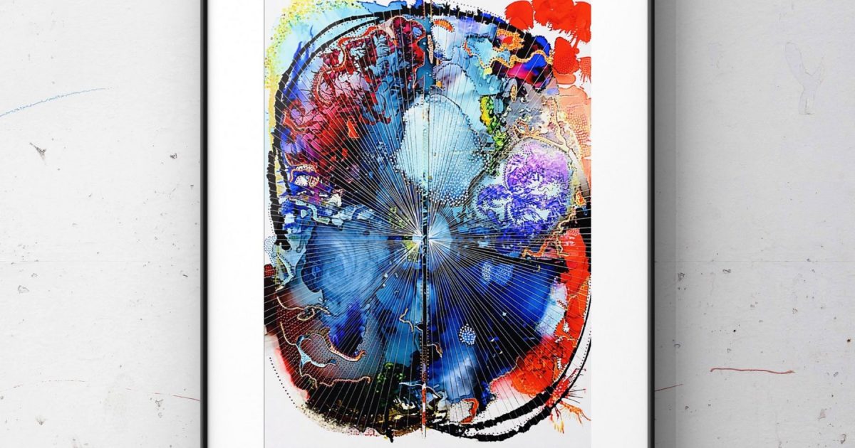 Artist With MS Finds Beauty, Individuality in MRI Brain Scans